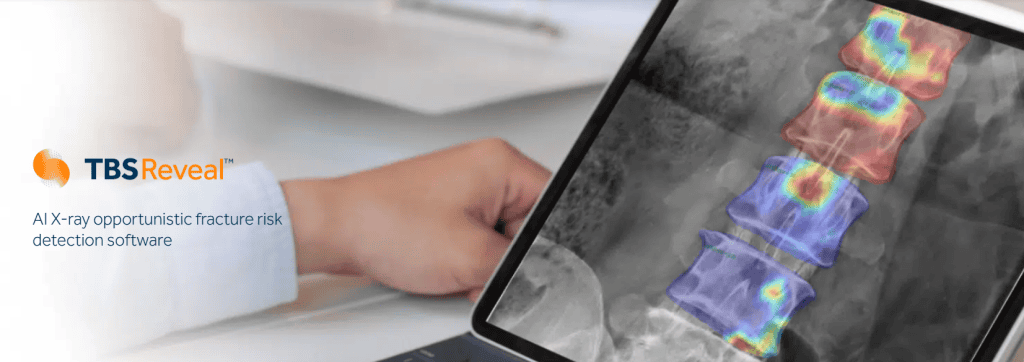 Understanding Trabecular Bone Score Codes
